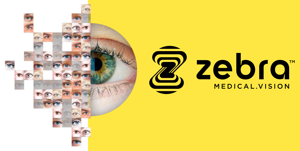 以色列醫學影像新創 Zebra 獲政府支援，觸及全國 90% 患者 | TechNews 科技新報